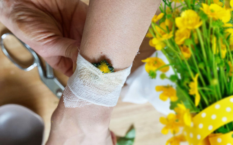 Definitive Buttercup Guide (With 5 Types & Growing Tips)