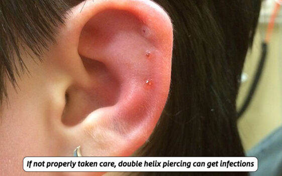Two helix piercing - The dos and don'ts to faster healing