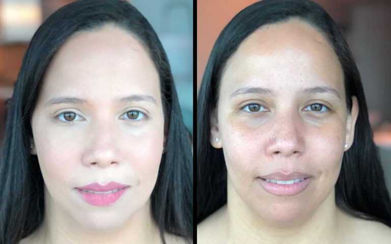 Read This Sallow Skin Guide & Look Younger Than Your Age