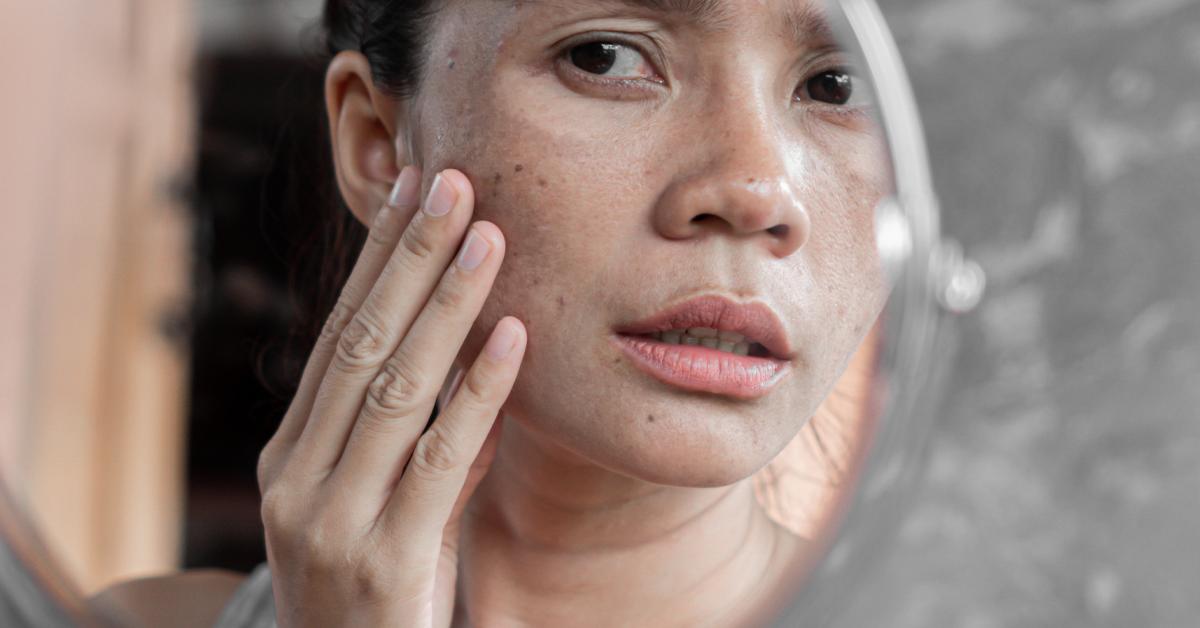 Read This Sallow Skin Guide & Look Younger Than Your Age