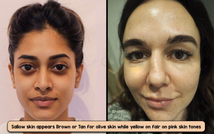 Read This Sallow Skin Guide & Look Younger Than Your Age
