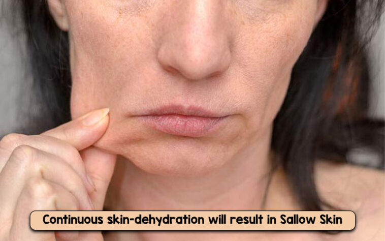 Read This Sallow Skin Guide & Look Younger Than Your Age