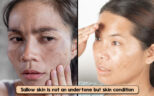 Read This Sallow Skin Guide & Look Younger Than Your Age