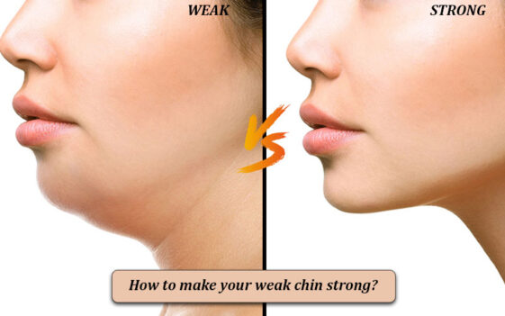 Weak Chin treatments – Exercises, Surgeries, & Makeup Hacks