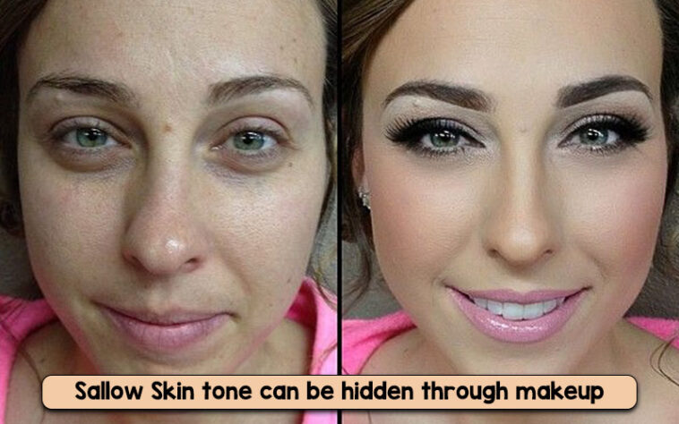 Read This Sallow Skin Guide & Look Younger Than Your Age