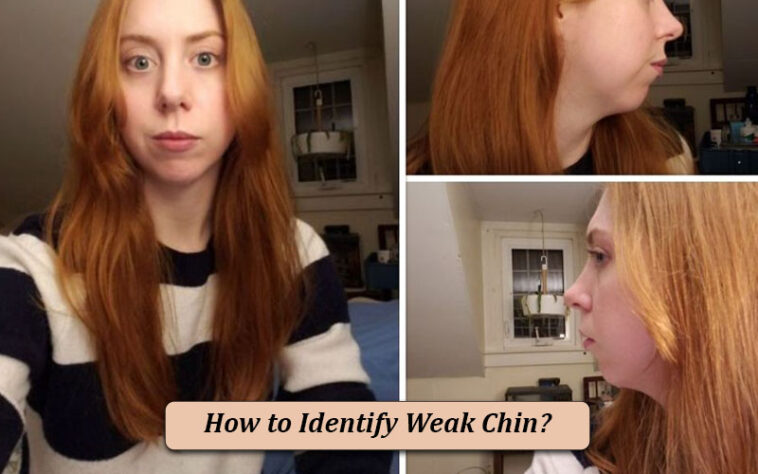 Weak Chin treatments – Exercises, Surgeries, & Makeup Hacks