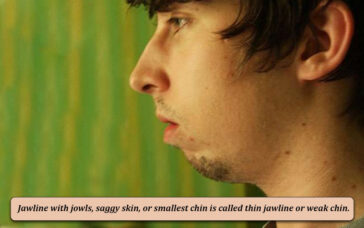 Weak Chin treatments – Exercises, Surgeries, & Makeup Hacks