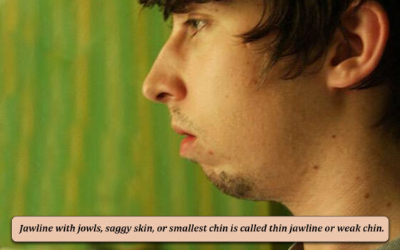 Weak Chin treatments – Exercises, Surgeries, & Makeup Hacks