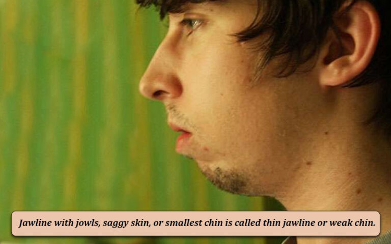 Weak Chin treatments – Exercises, Surgeries, & Makeup Hacks